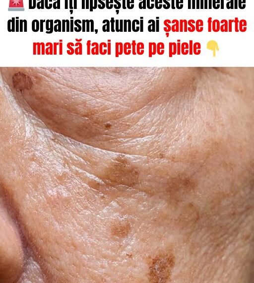 Dacă îți lipsește aceste minerale din organism, atunci ai șanse foarte ...